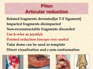 Pilon fractures reduction and fixation technics-dr mohamed ashraf-govt ...