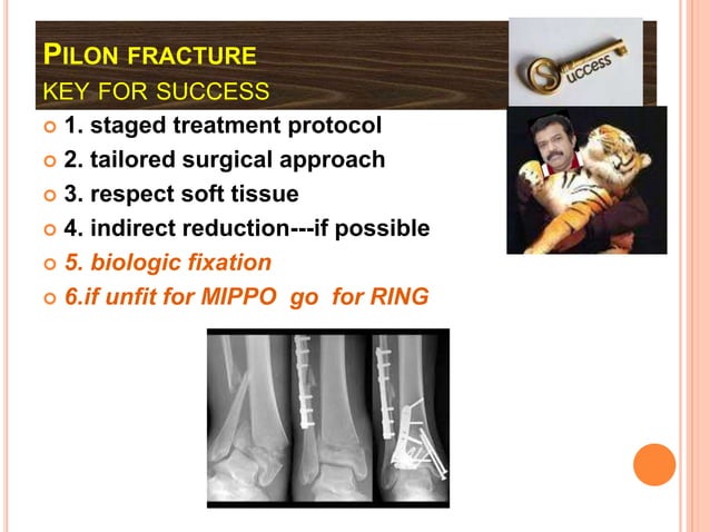 Pilon fractures reduction and fixation technics-dr mohamed ashraf-govt ...