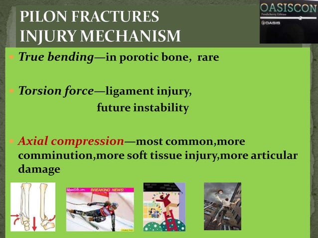 Pilon fractures reduction and fixation technics-dr mohamed ashraf-govt ...
