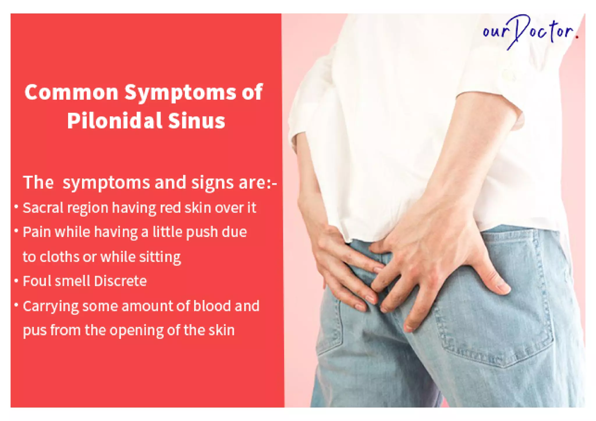 Pilonidal sinus | PDF
