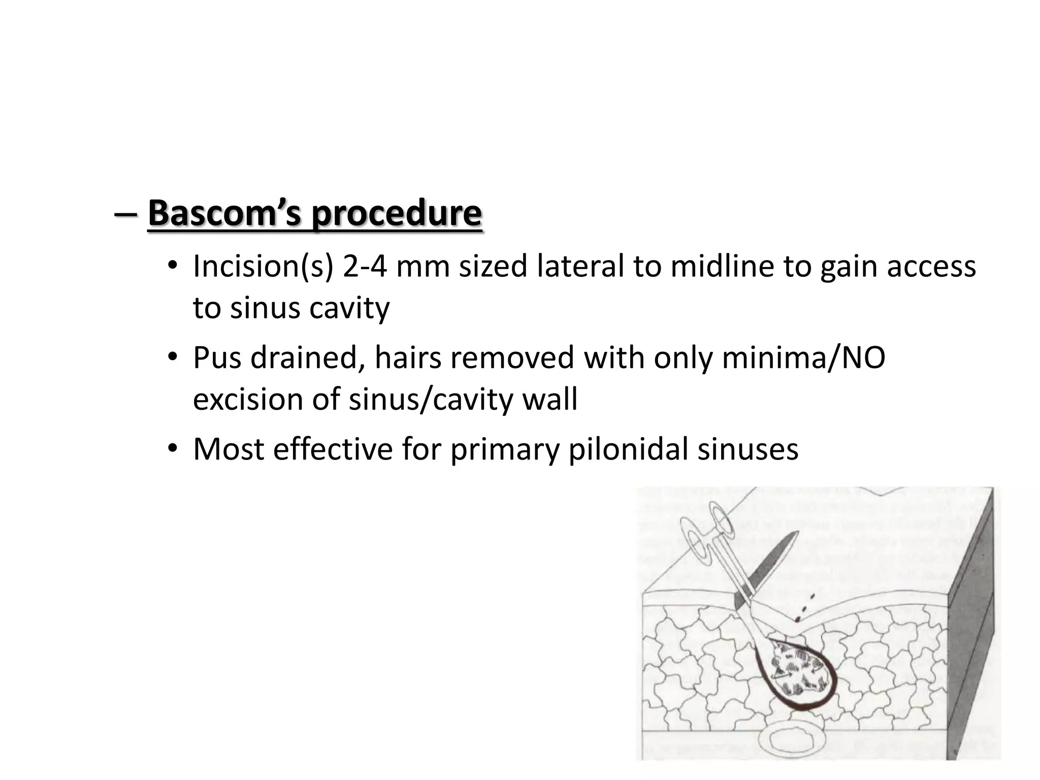 Pilonidal Disease | PPTX