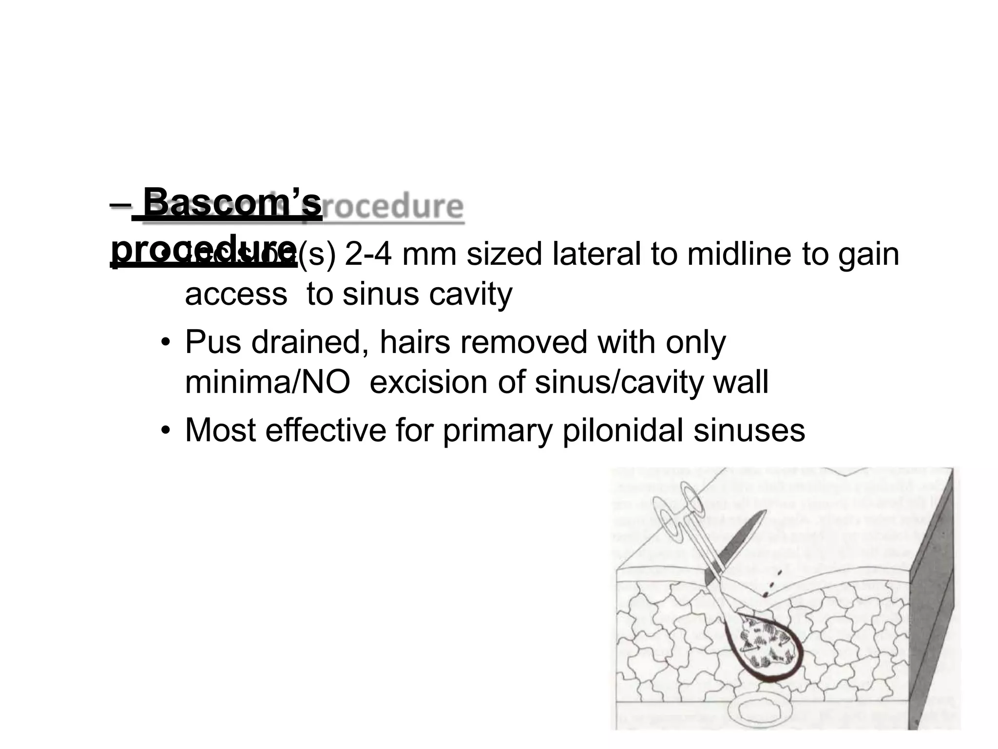 pilonidaldisease-.pptx
