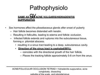pilonidaldisease-.pptx