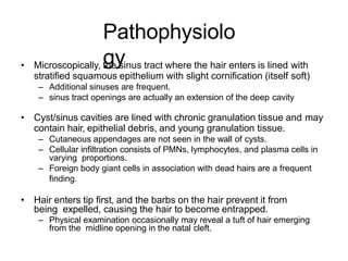 pilonidaldisease-.pptx