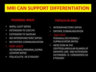 Pilonidal sinus | PPTX