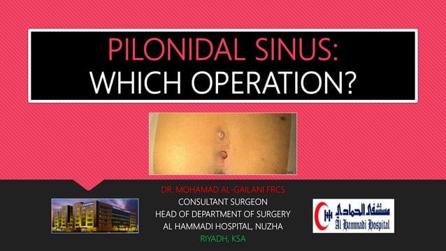 Pilonidal Sinus: Which Operation? | PPTX | Ear, Nose and Throat ...