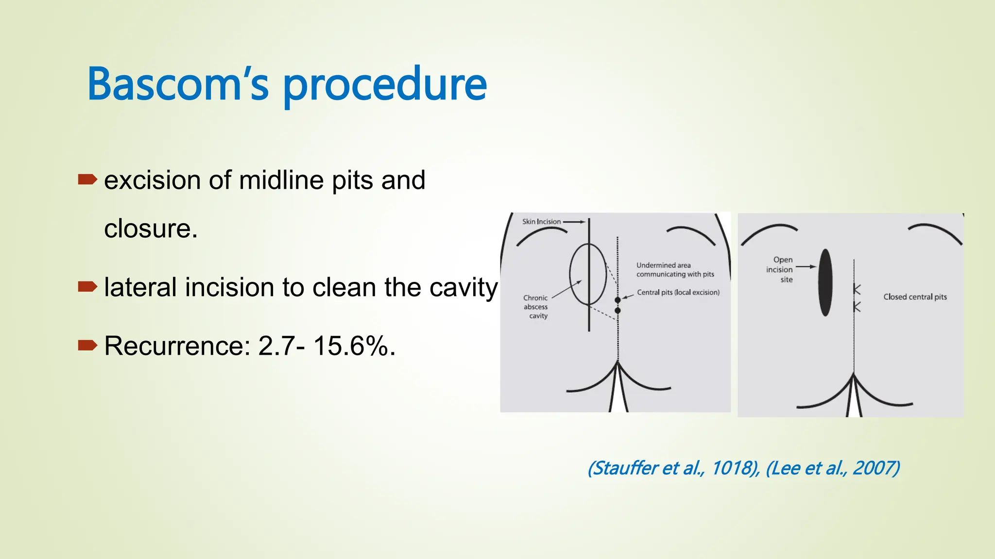 pilonidal sinus.pptx