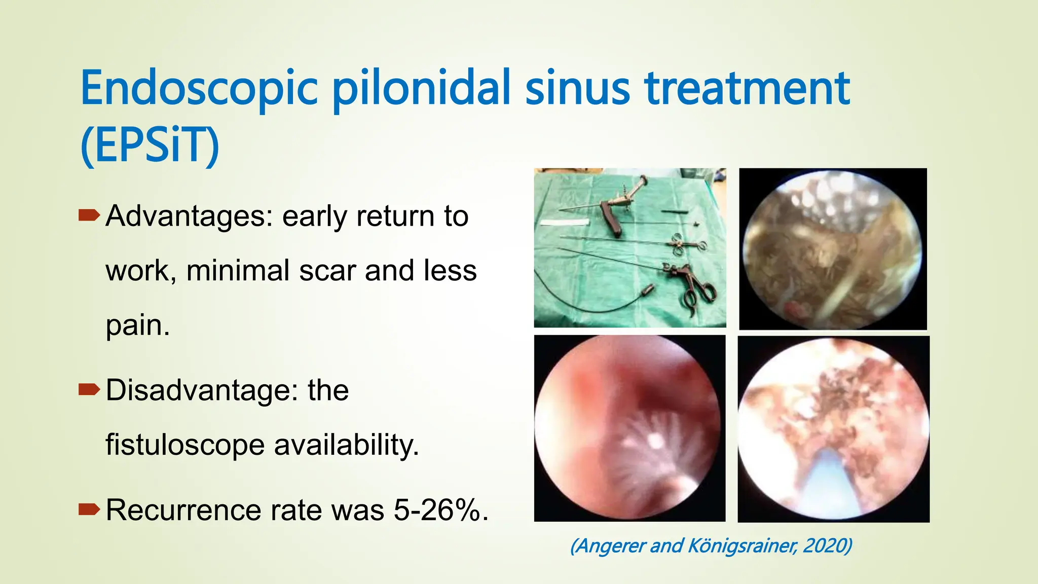 pilonidal sinus.pptx