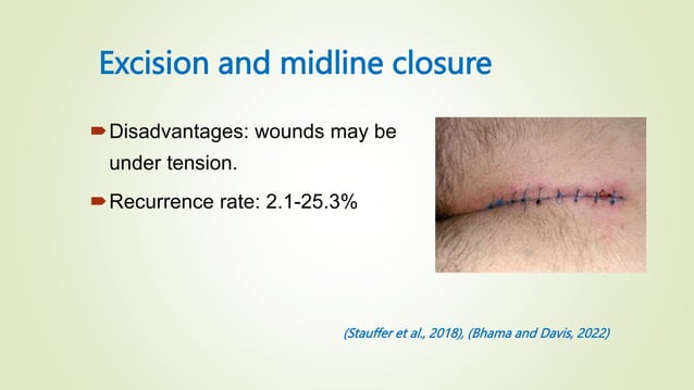pilonidal sinus.pptx