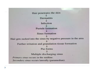 Pilonidal Sinus Definition types history examination treatment | PPT