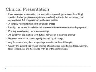 Pilonidal Sinus Definition types history examination treatment | PPT