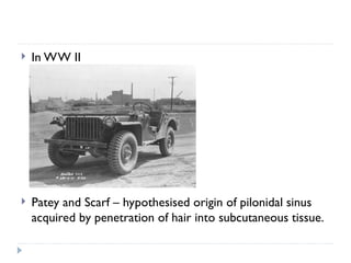 Pilonidal Sinus Definition types history examination treatment | PPT