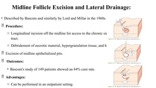 PILONIDAL SINUS ETIOLOGY DIAGNOSIS TREATMENT .pptx