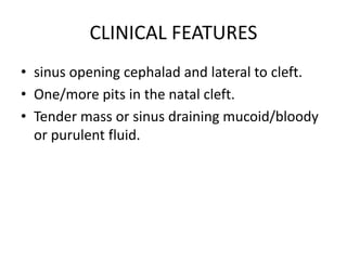 Pilonidal sinus 19 AUG 22.pptx