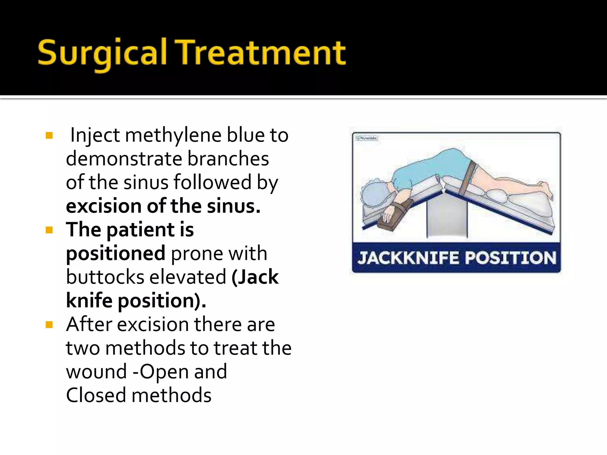 PILONIDAL SINUS2.pptx