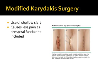 PILONIDAL SINUS2.pptx