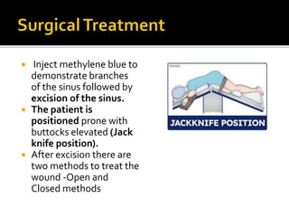 PILONIDAL SINUS2.pptx