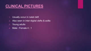 Pilonidal sinus diagnosis and management (colorectal surgery) | PPTX