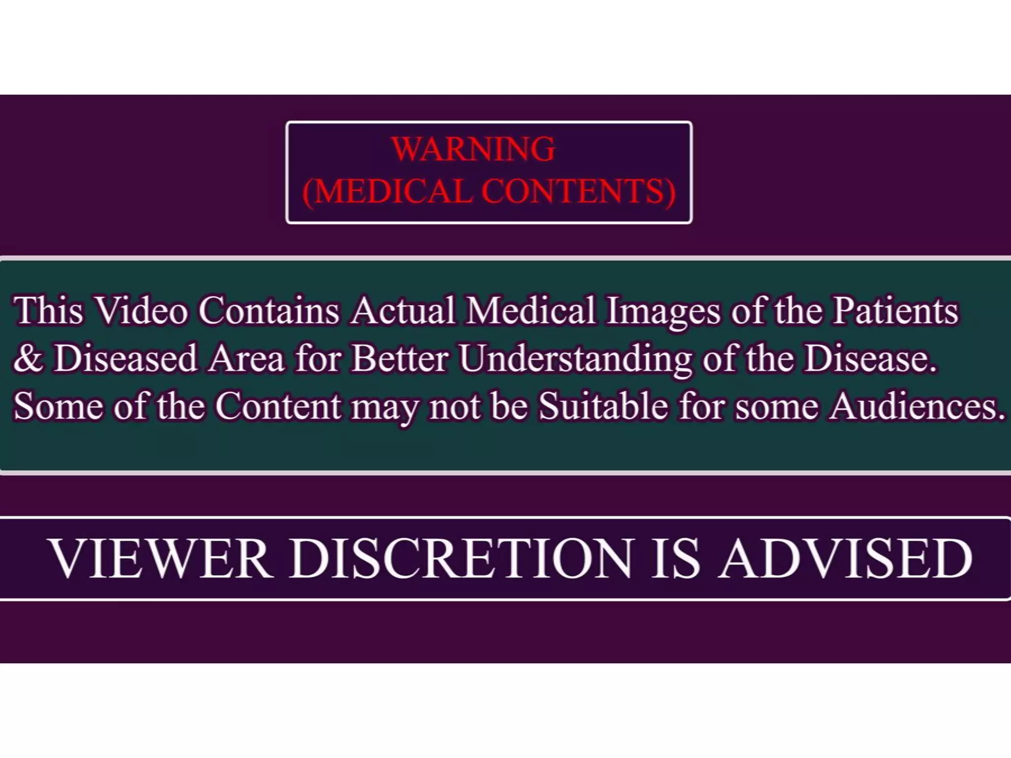 Pilonidal Sinus : Common Presentations with original pictures | PDF