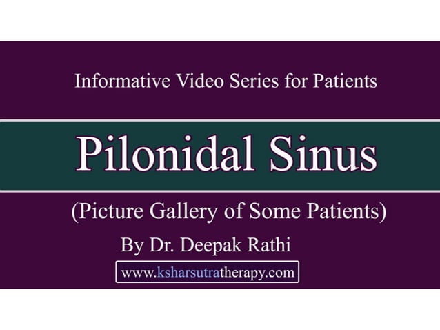 Pilonidal Sinus : Common Presentations with original pictures | PDF ...