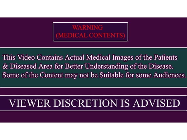 Pilonidal Sinus : Common Presentations with original pictures | PDF ...