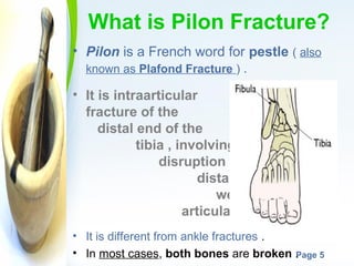 pilon fractures or " plafond " | PPT