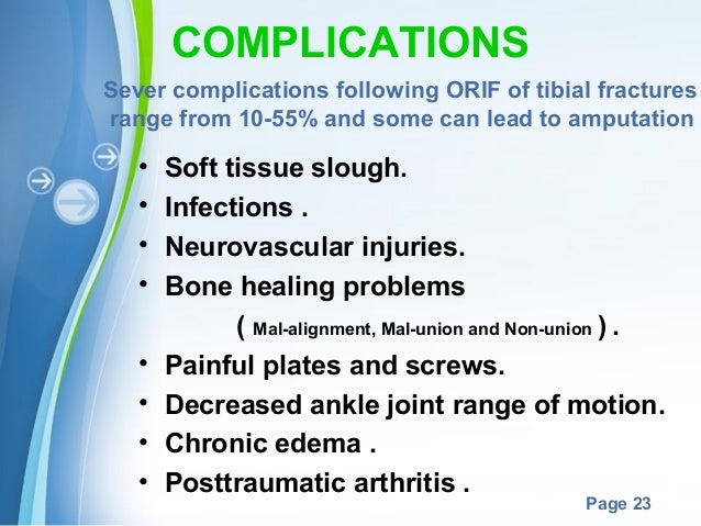 pilon fractures or " plafond