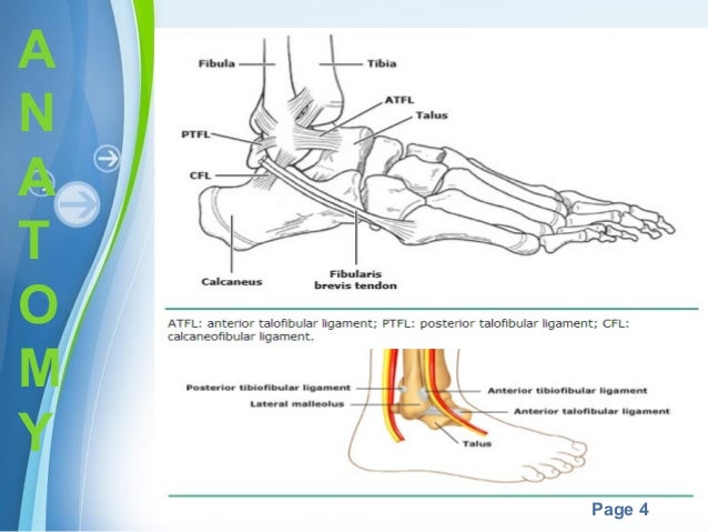 pilon fractures or " plafond