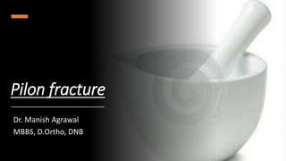 Pilon fracture | PPTX