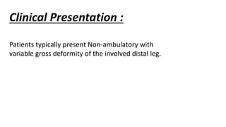 Pilon fracture | PPTX
