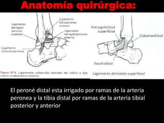 Pilon tibial | PPTX