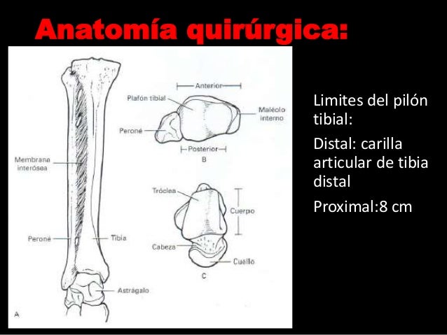 Pilon tibial