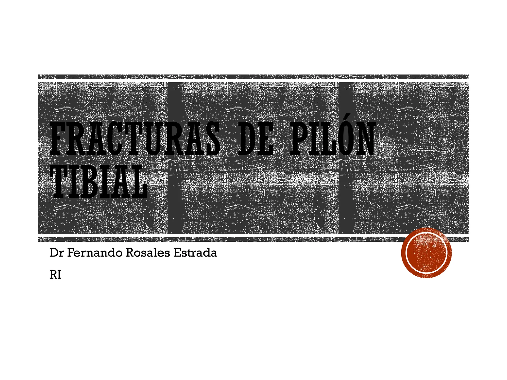 PILON TIBIAL, extremos distal de tibia.. | PPTX