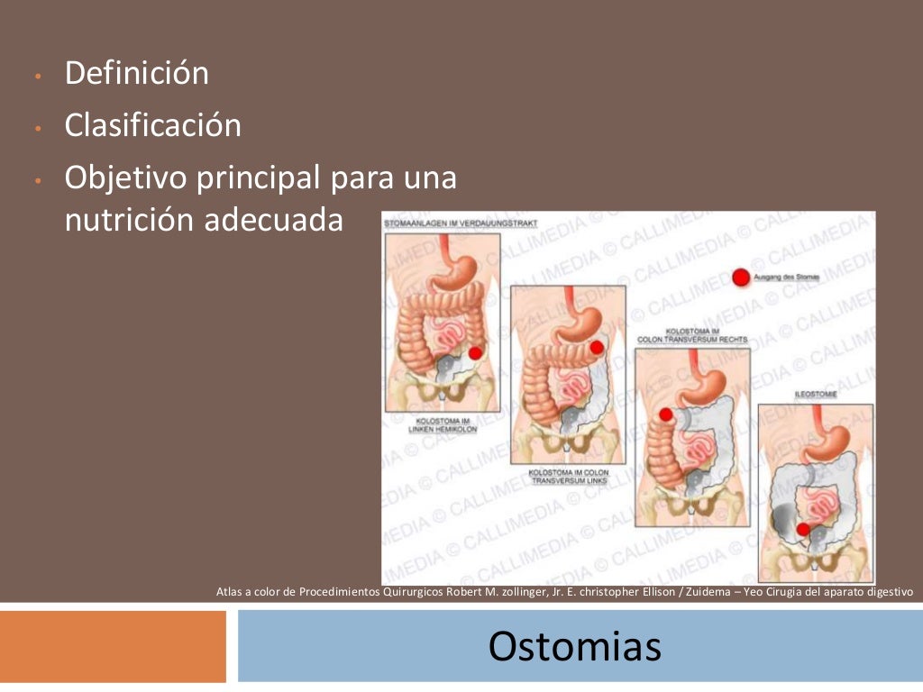Piloroplastia, gastrostomia, yeyunostomia, ileostomia y colostomia.