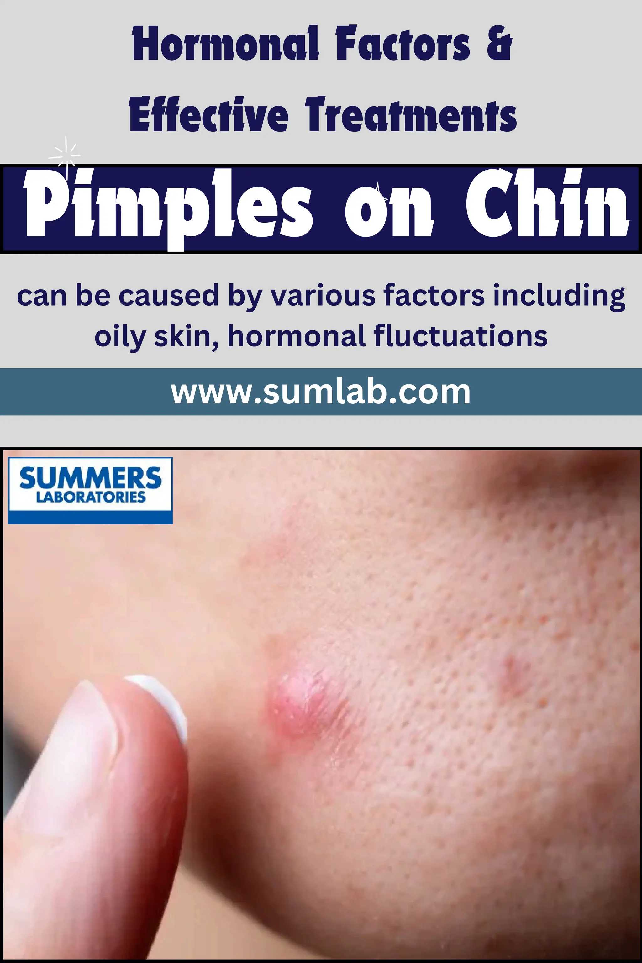 How do I stop pimples from growing on my chin? | PDF