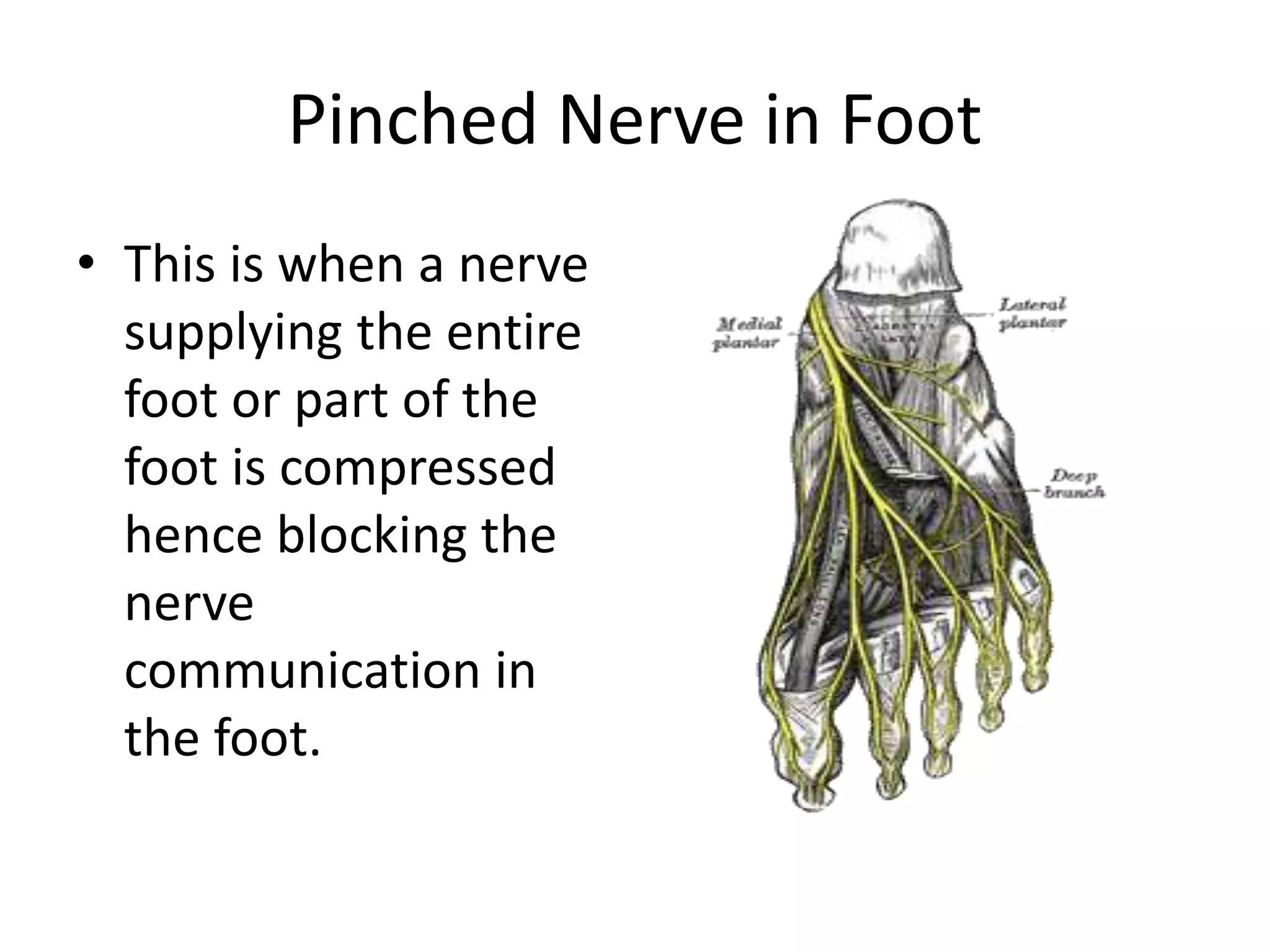 How to Get Rid of Pinched nerve in foot | PPT