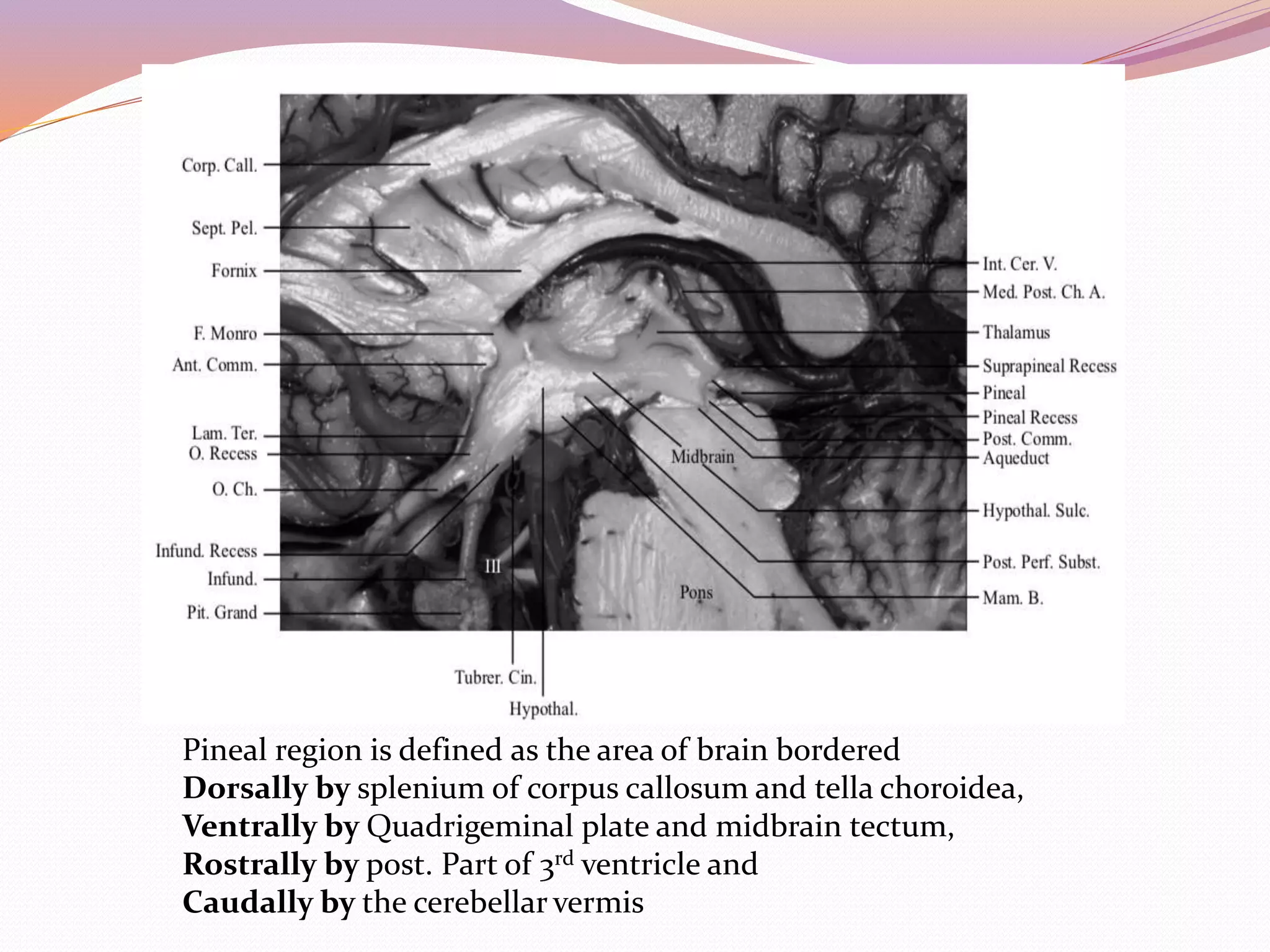 Pineal region tumors | PPTX