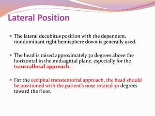 Pineal region tumors | PPTX