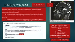 pineal gland tumors ( pineal gland )- approach | PPTX