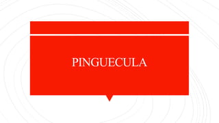 PINGUECULA Disease of eye sclera and Conjunctiva.pptx