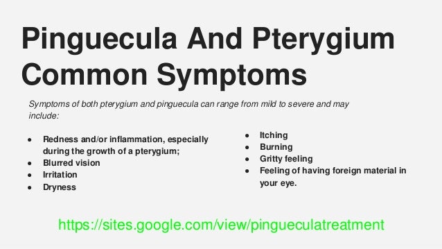 Pinguecula Treatment Presentation With Signs, Symptoms, And Remedies