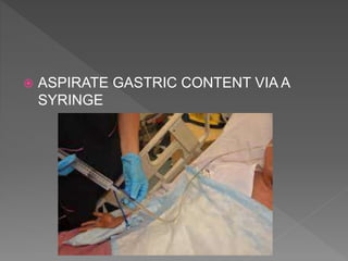 Pinkcity nursing classes ng tube | PPTX