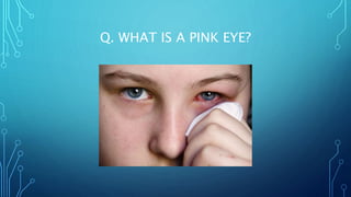 Pink eye | PPTX