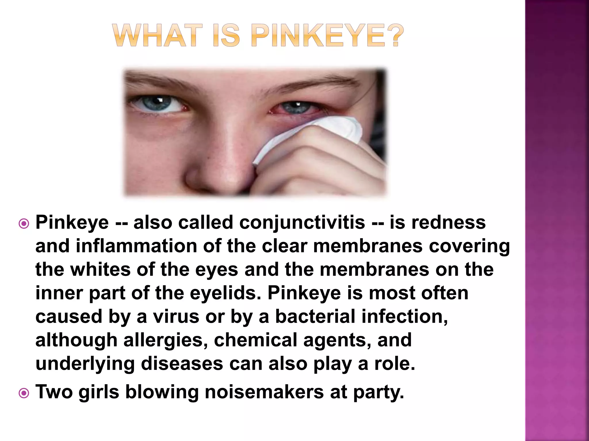 Pinkeye {conjunctivitis} | PPTX