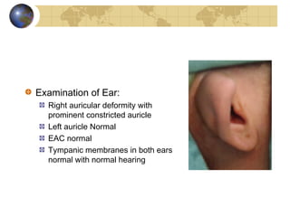 Pinnaplasty case presentation | PPT