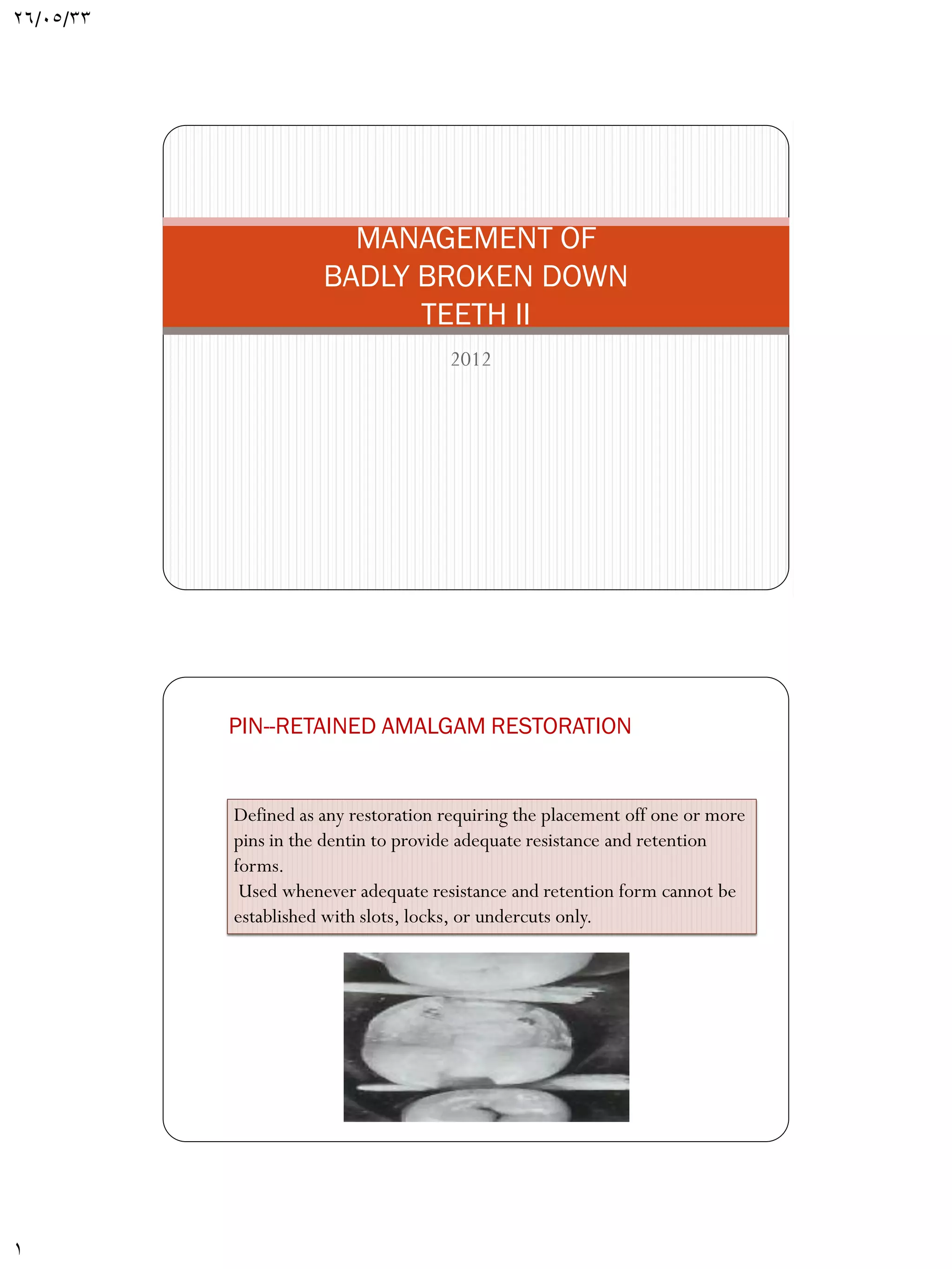 Pin retained amalgam restorations | PDF