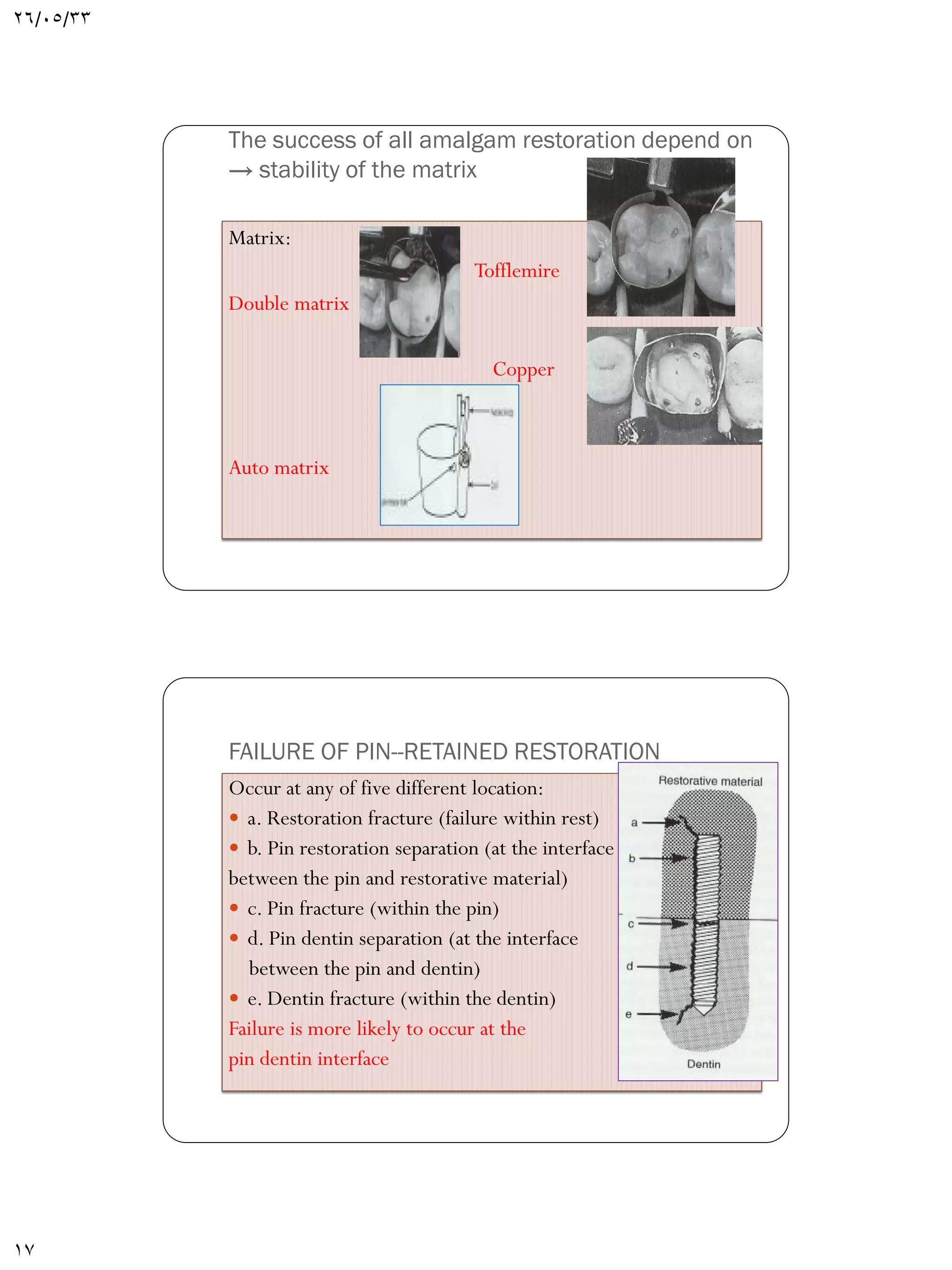 Pin retained amalgam restorations | PDF