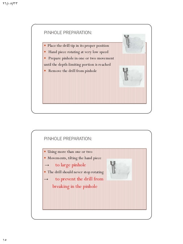 Pin Retained Amalgam Restoration Predictably Restoring Endodontically