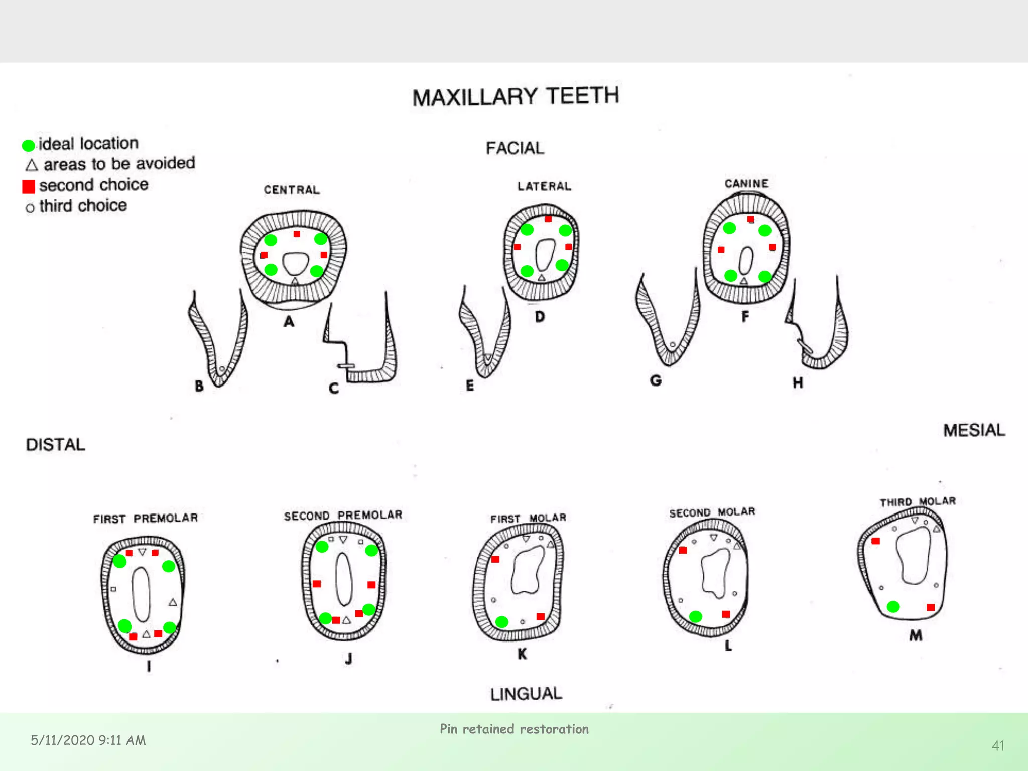 Pin retained restorations | PPTX