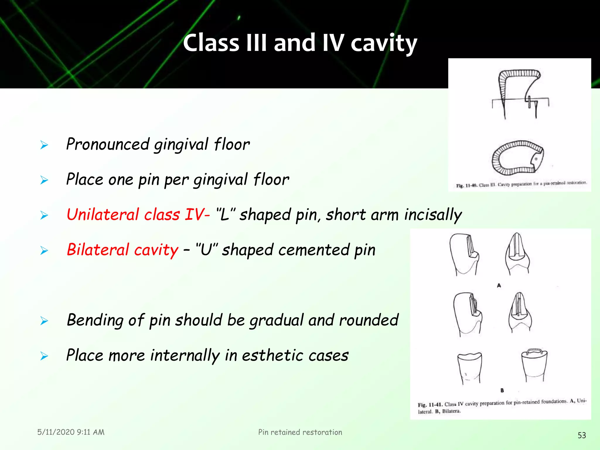 Pin retained restorations | PPTX